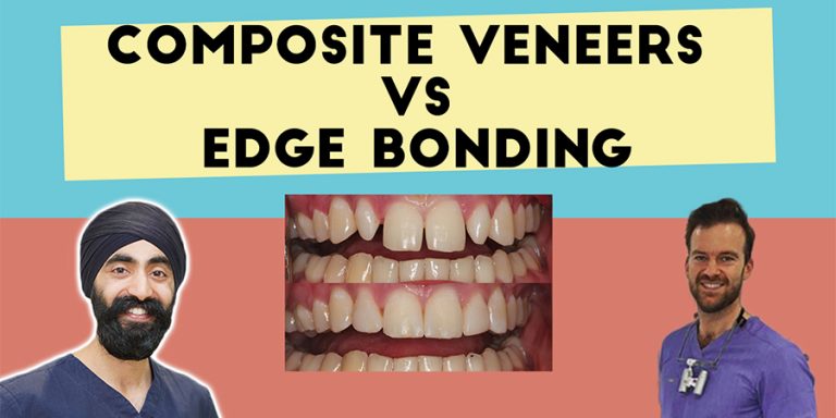 Composite Veneers vs Edge Bonding – Biomimetic Dentistry with George ...