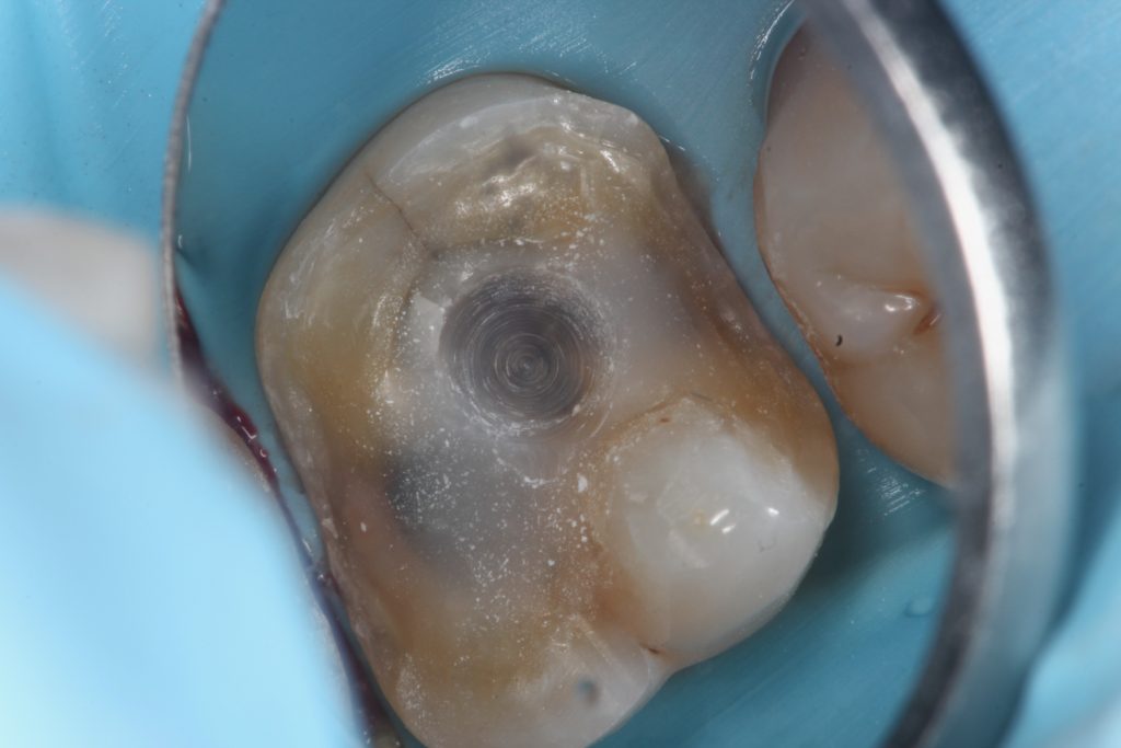 Protrusive Dental Pearls – Protrusive Dental Podcast