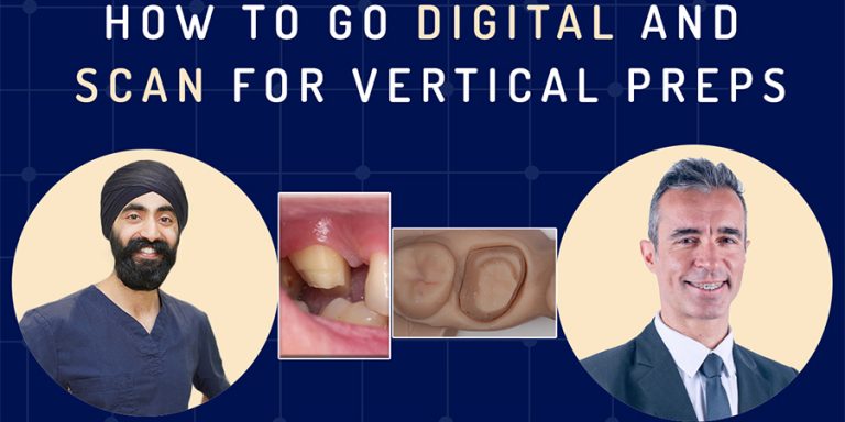 Vertiprep Revision and How To Go Digital for Vertical Preps – PDP089 ...