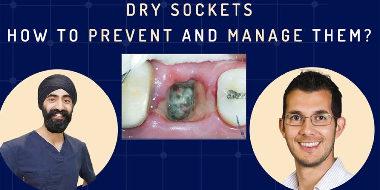 Dry Sockets – How to Prevent and Manage Them? – GF010 – Protrusive ...