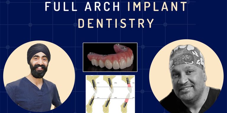 What We Ought To Know About Full Arch Implant Dentistry – PDP093 ...