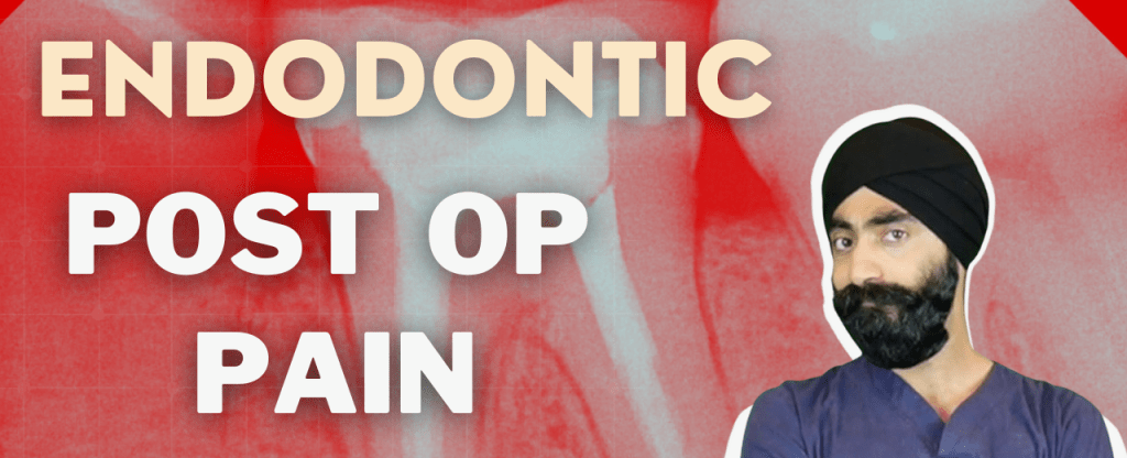 Post Operative Pain after Endodontics – Prevention and Management ...