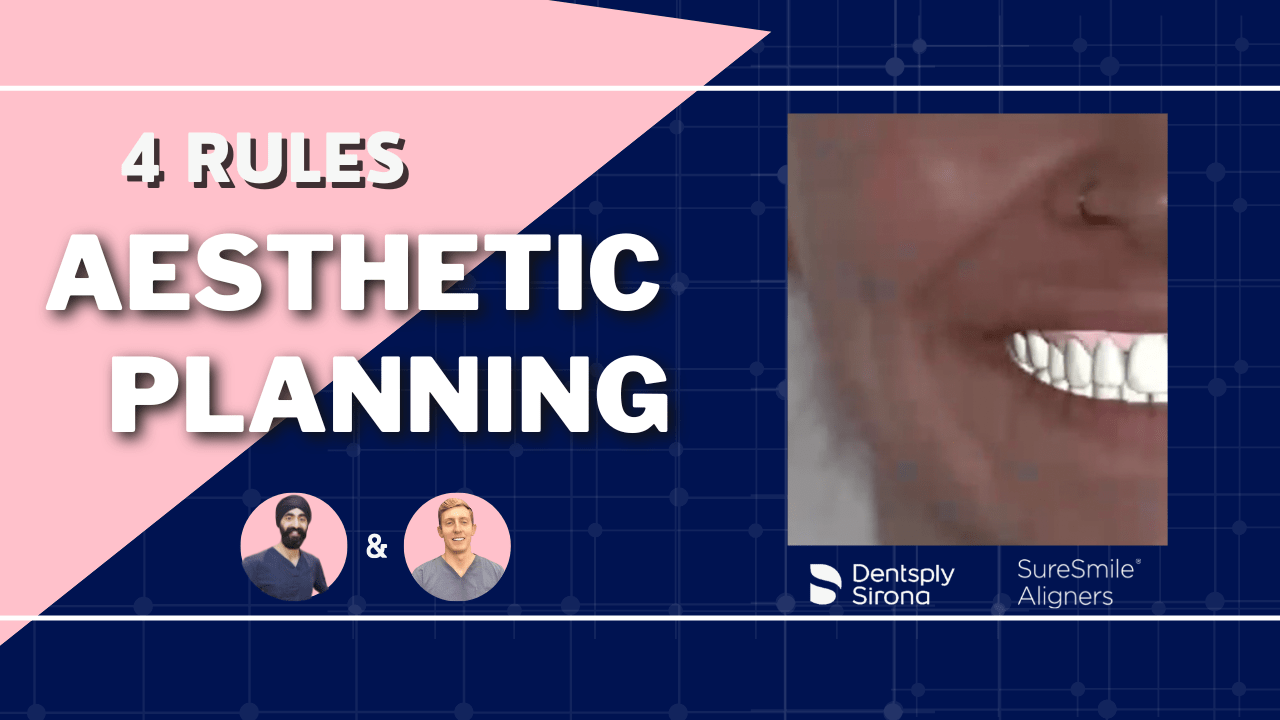 4 Rules of Planning Aesthetic Dentistry (Ortho-Resto) – PDP129 ...