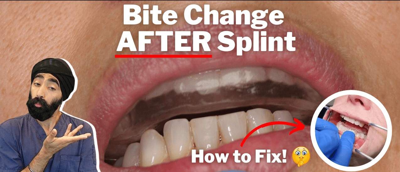 A Little Trick to Solve Anterior Open Bites after Occlusal Appliances ...