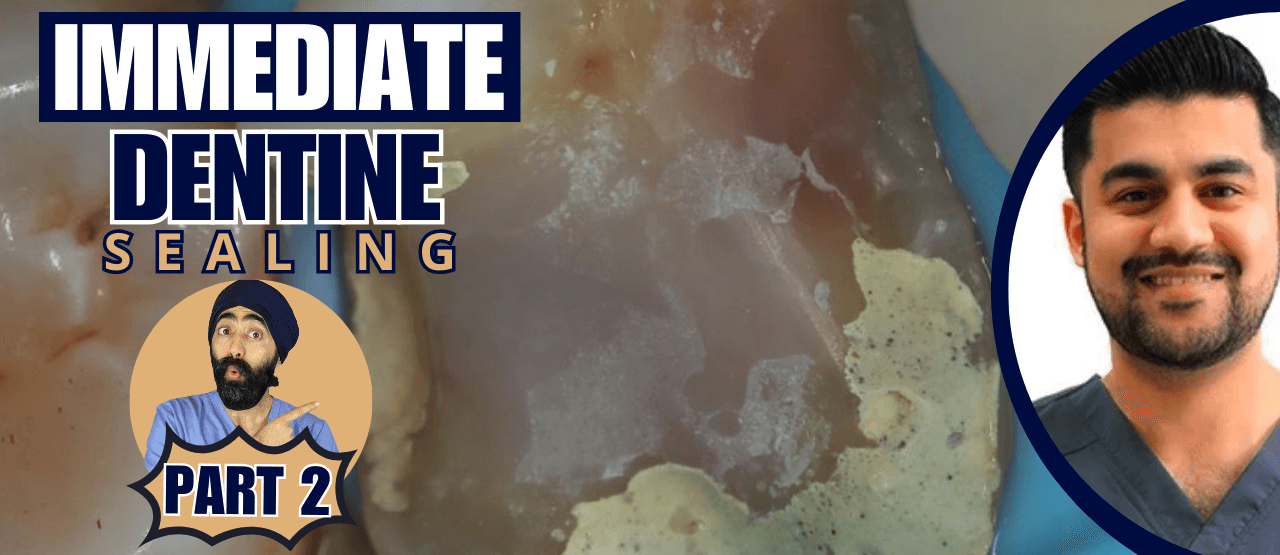Immediate Dentine Sealing Tutorial Part 2 – PDP174 – Protrusive Dental ...