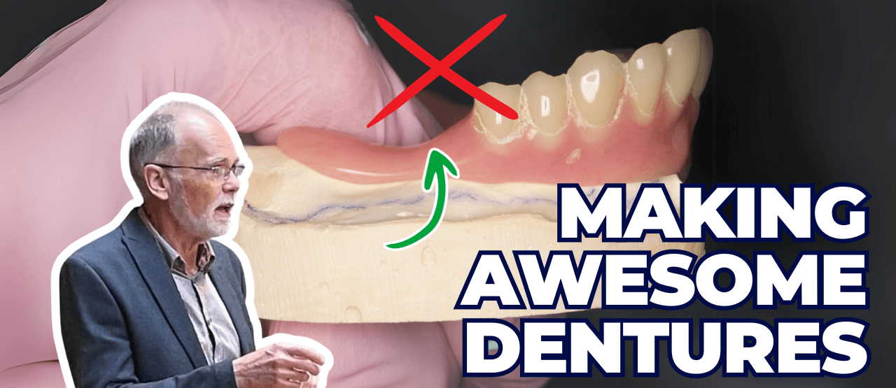 Making Awesome Dentures – Border Moulding and Beyond – PDP205 ...
