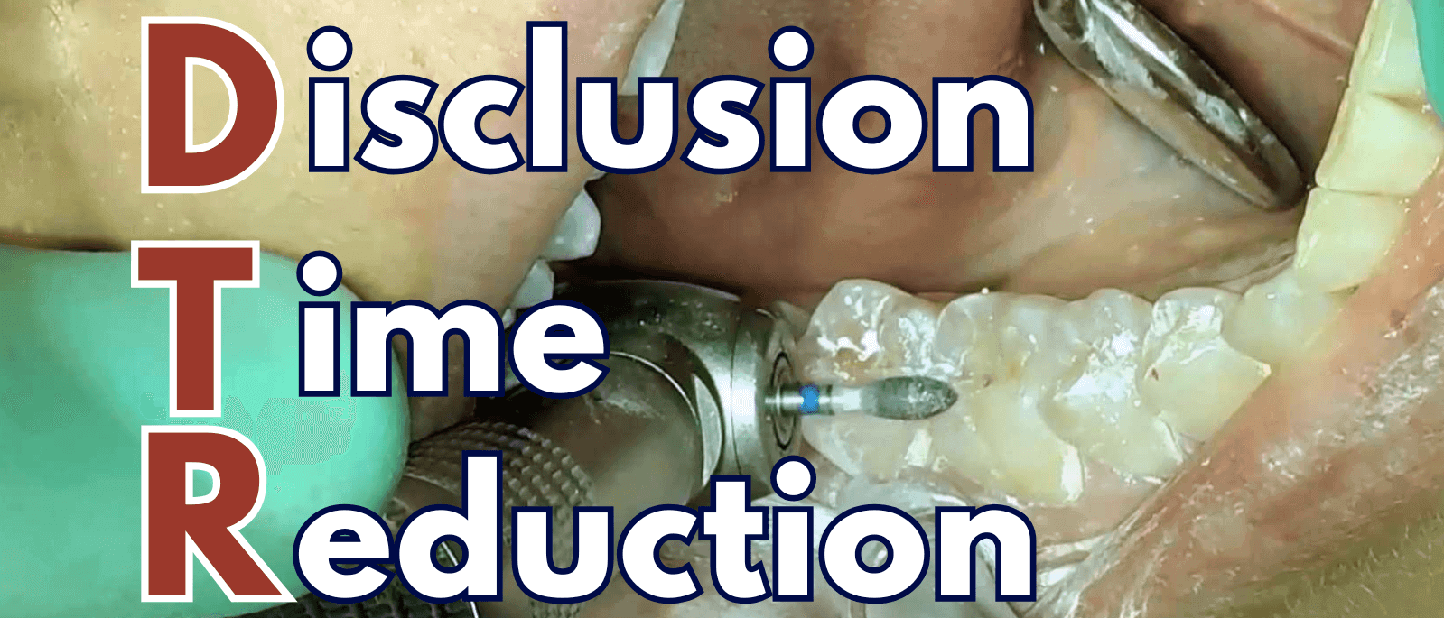 Can Occlusal Adjustment Cure TMD? ‘DTR’ and T Scan Experience – PDP255 ...